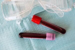 37 Unique Blood Dream Meaning | Dream Guide Hub